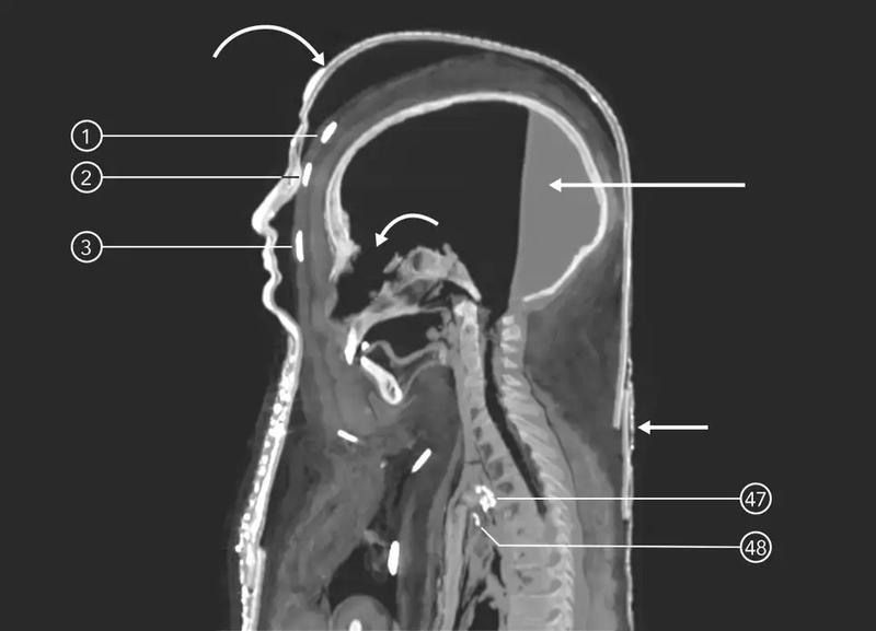 少年ミイラの秘密がCTスキャンで明かされる。おそらく富裕層です | ギズモード・ジャパン